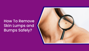 How To Remove Skin Lumps and Bumps Safely?