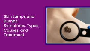 From Cysts to Warts: A Guide to Common Types of Skin Lumps & Bumps