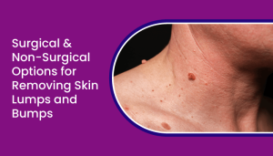 Surgical & Non-Surgical Options for Removing Skin Lumps & Bumps
