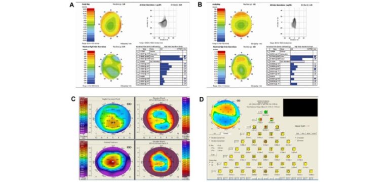 Eye OCT Scans & Diagnosis, Shrewsbury